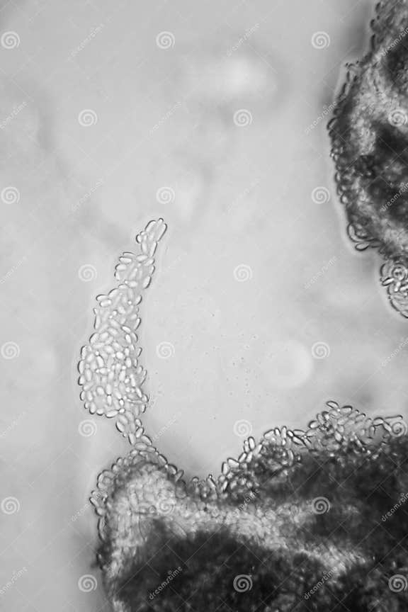 Mold at the microscope stock image. Image of microbes - 111147729