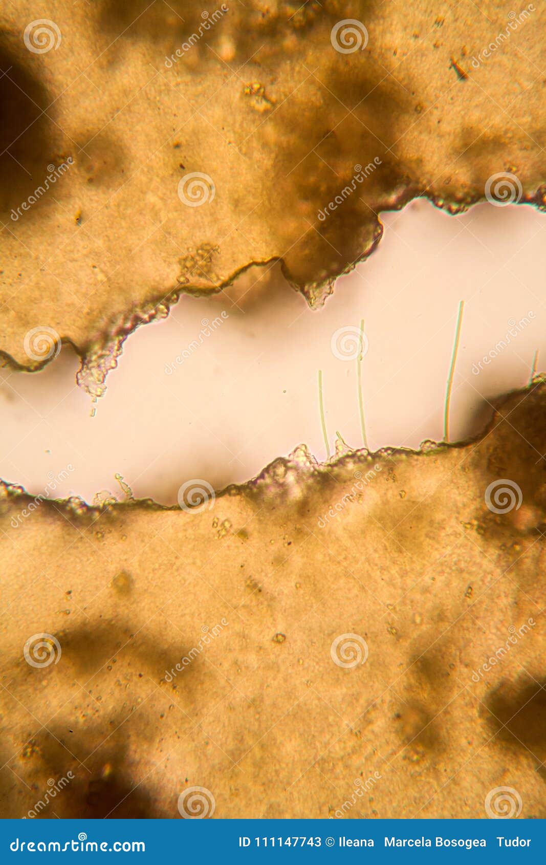 Mold at the microscope stock image. Image of beautiful - 111147743