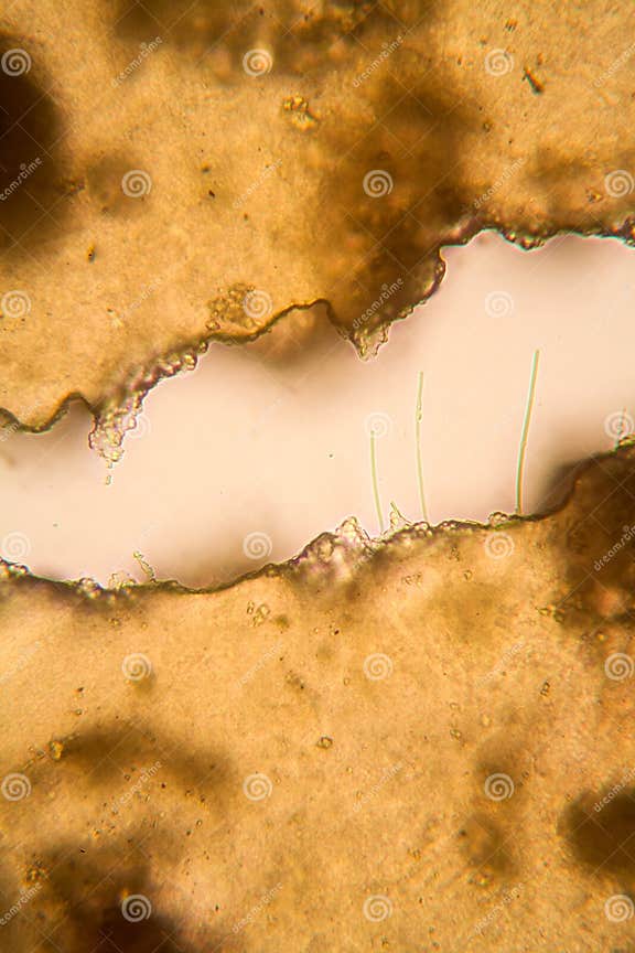 Mold at the microscope stock image. Image of beautiful - 111147743