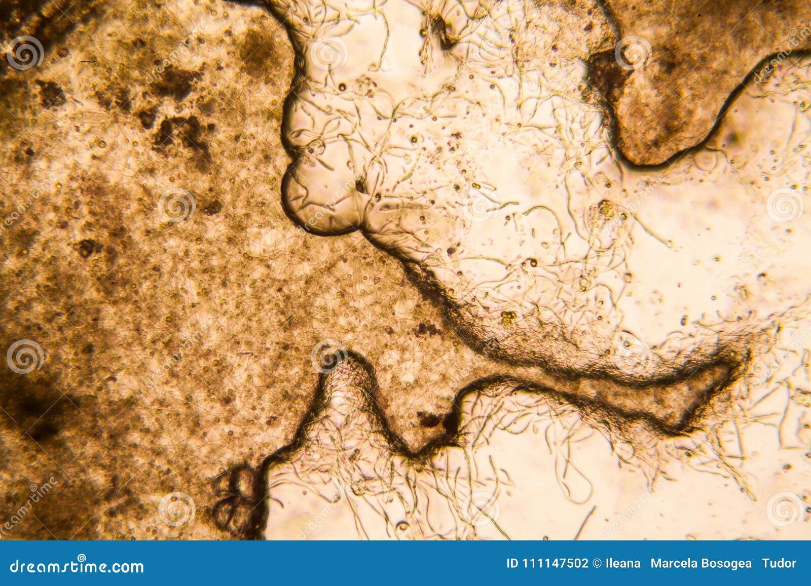Mold at the microscope stock photo. Image of health - 111147502