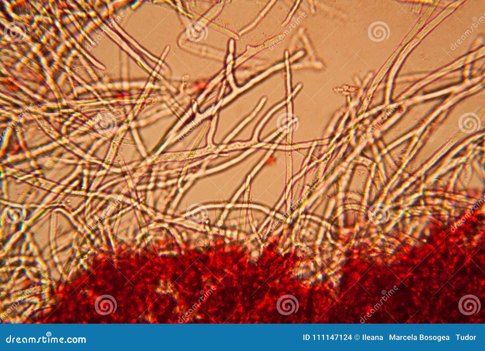 Mold at the microscope stock photo. Image of health - 111147124