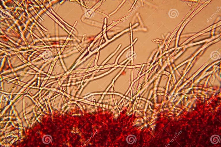 Mold at the microscope stock photo. Image of health - 111147124