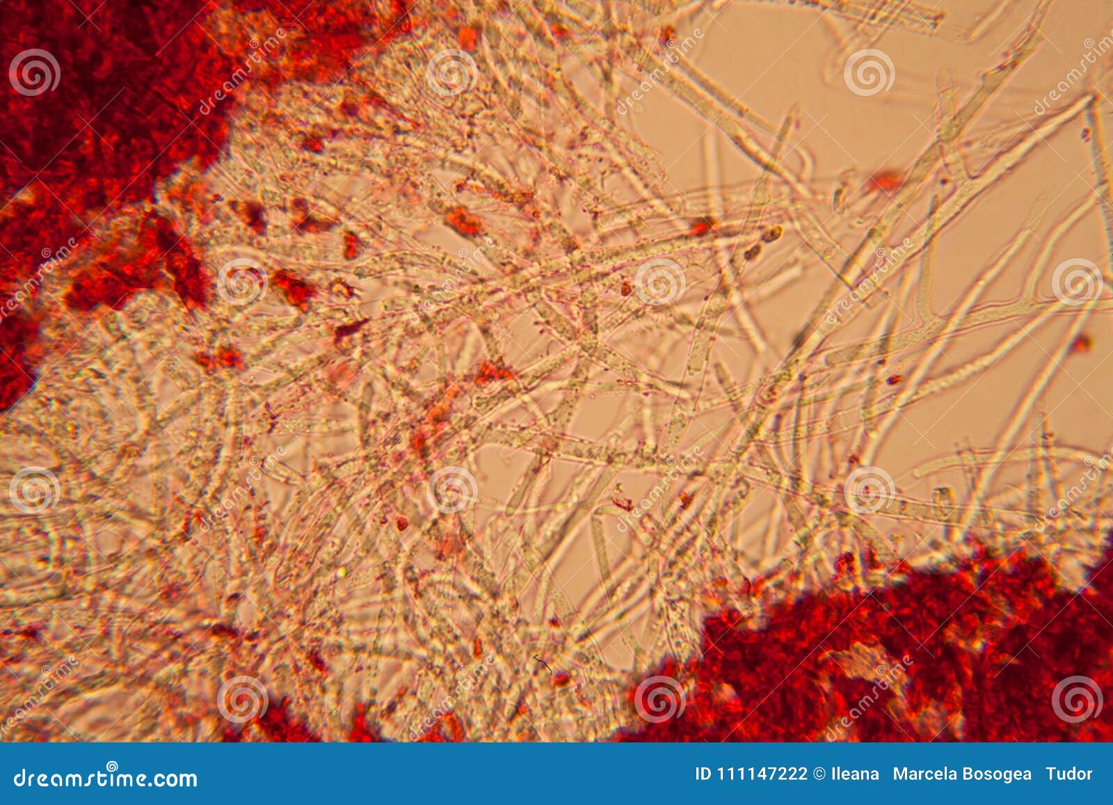 Mold at the microscope stock photo. Image of abstract - 111147222