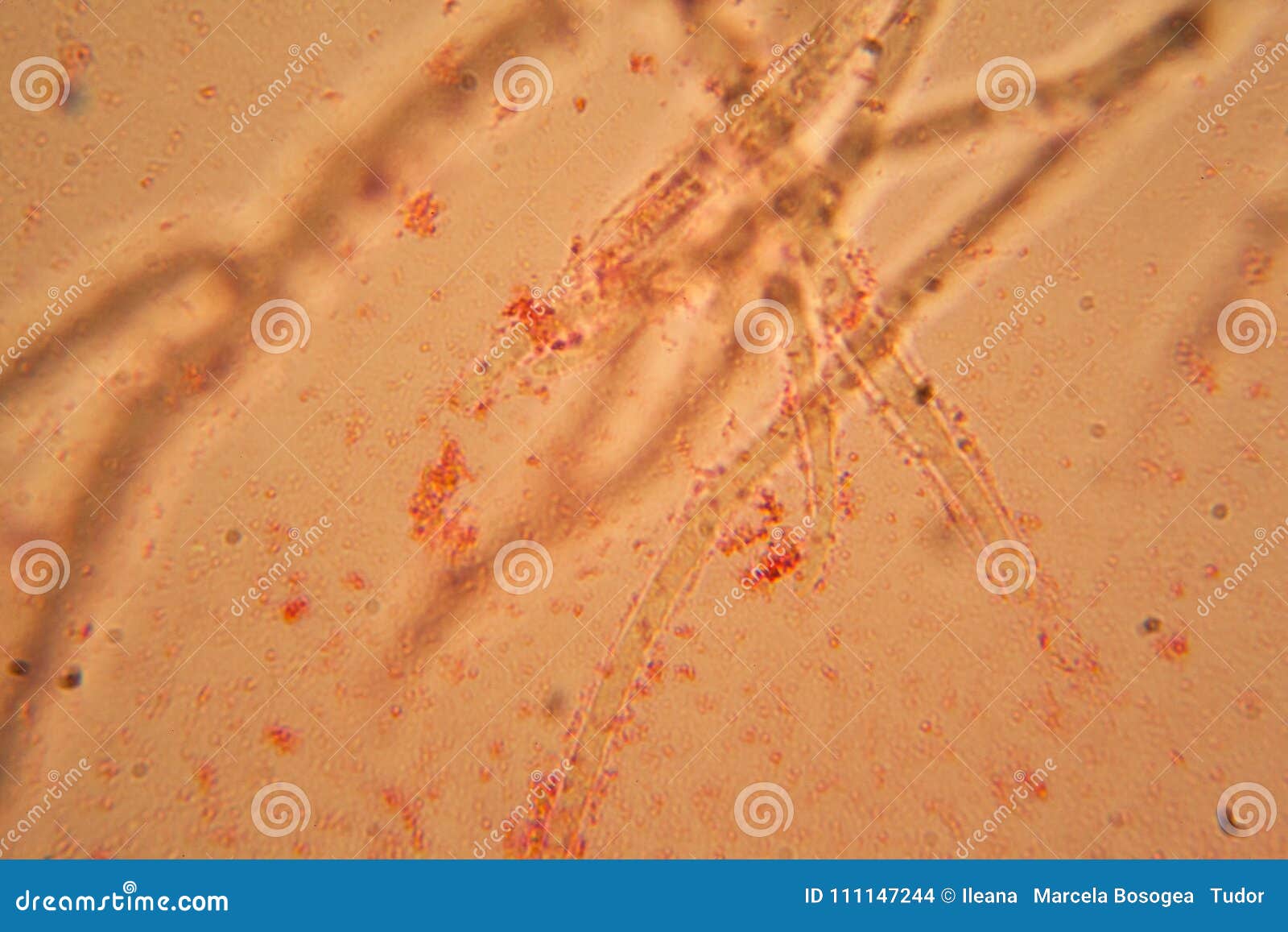 Mold at the microscope stock photo. Image of fungal - 111147244