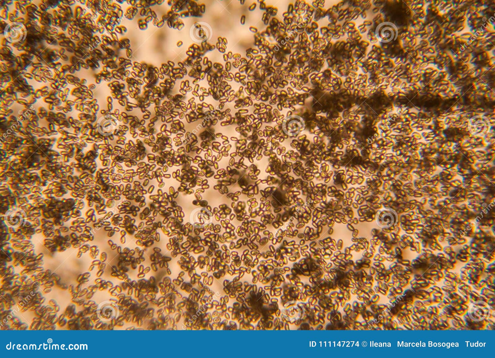 Mold at the microscope stock photo. Image of background - 111147274