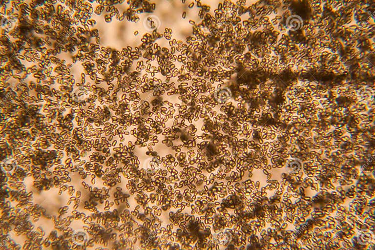 Mold at the microscope stock photo. Image of background - 111147274