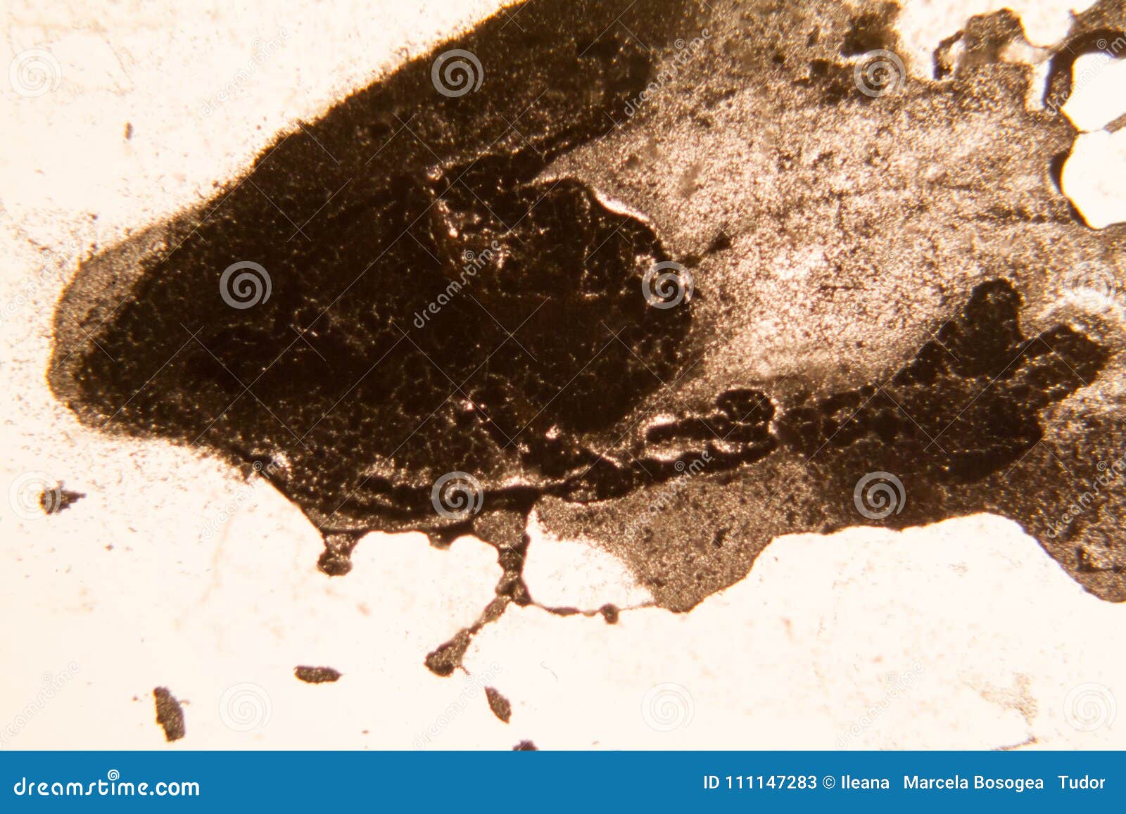 Mold at the microscope stock image. Image of fungal - 111147283
