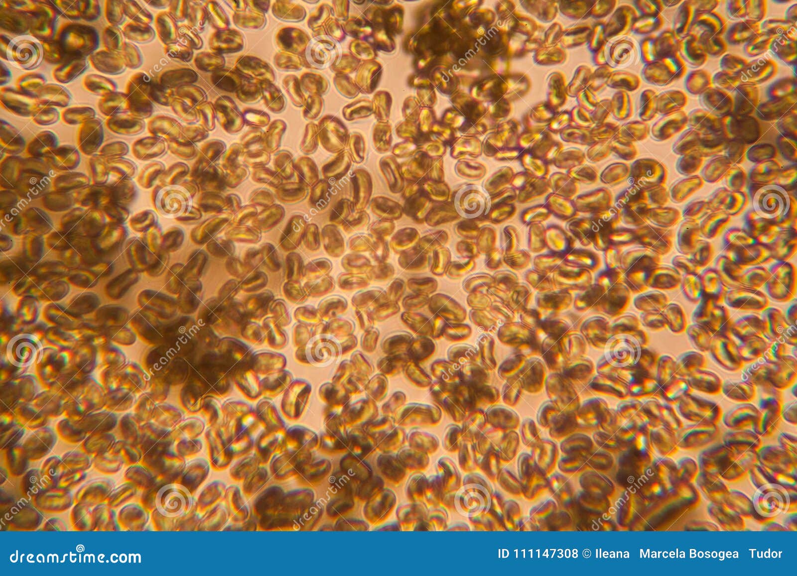 Mold at the microscope stock photo. Image of fungal - 111147308