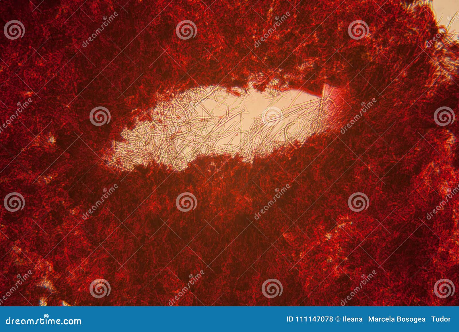 Mold at the microscope stock photo. Image of microscope - 111147078