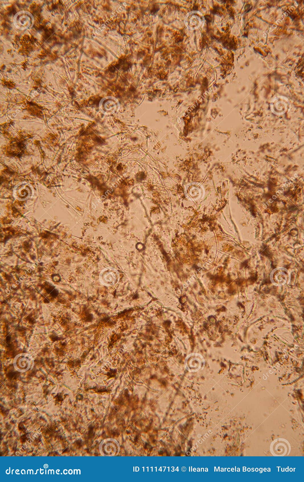 Mold at the microscope stock photo. Image of medicine - 111147134