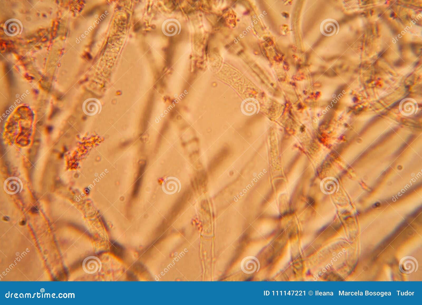 Mold at the microscope stock image. Image of mold, life - 111147221