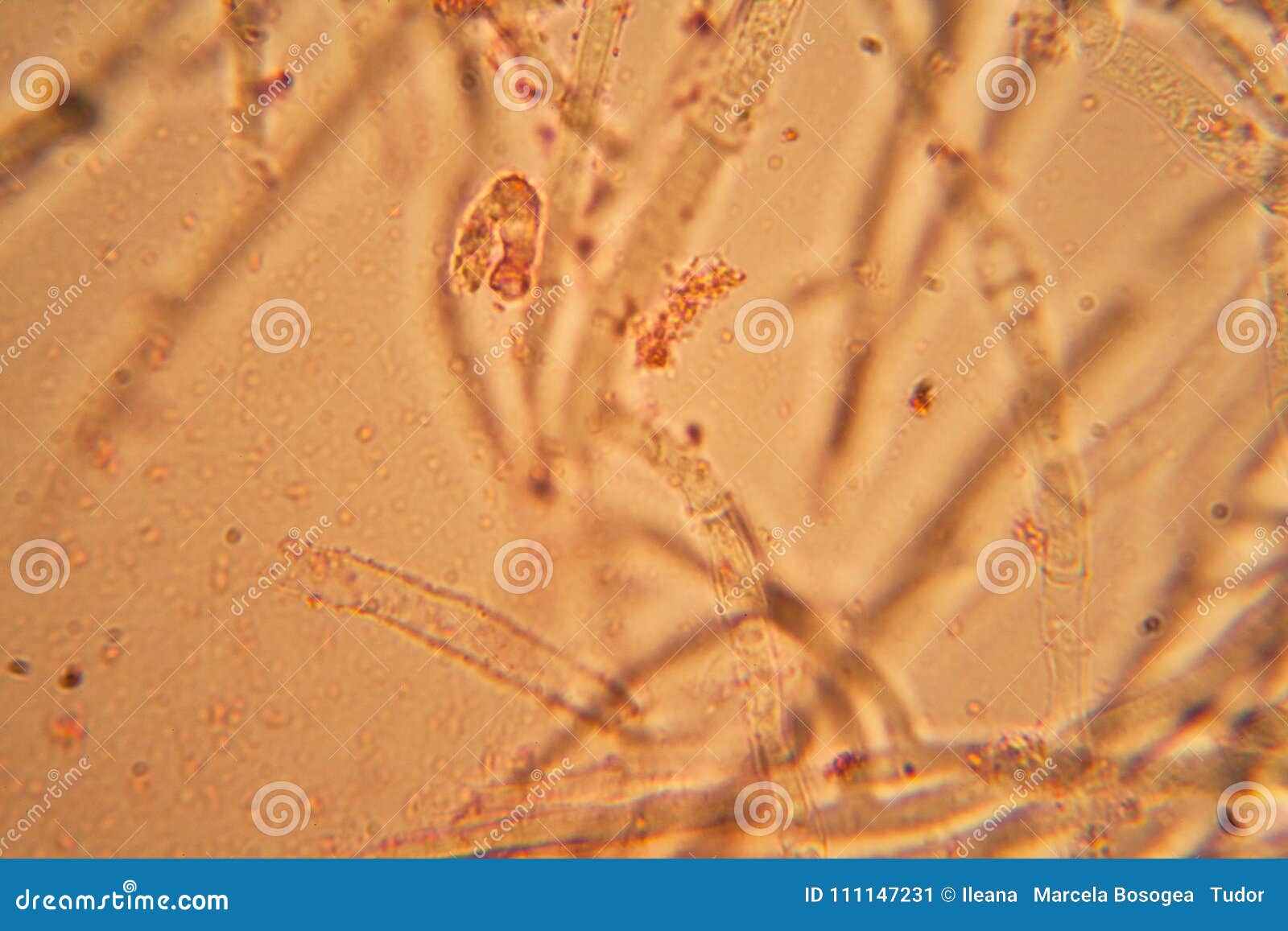Mold at the microscope stock image. Image of details - 111147231
