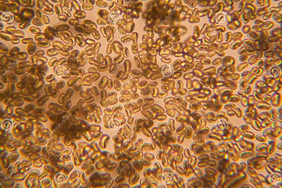 Mold at the microscope stock image. Image of agriculture - 111147293