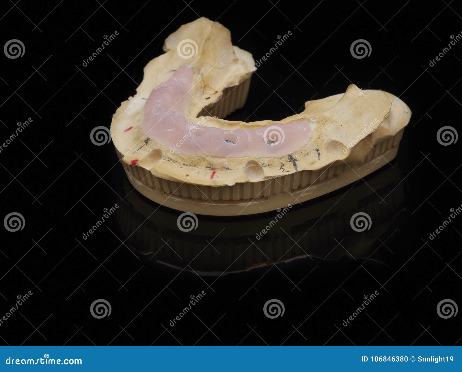 Mold stock photo. Image of care, dent, laboratory, metal - 106846380