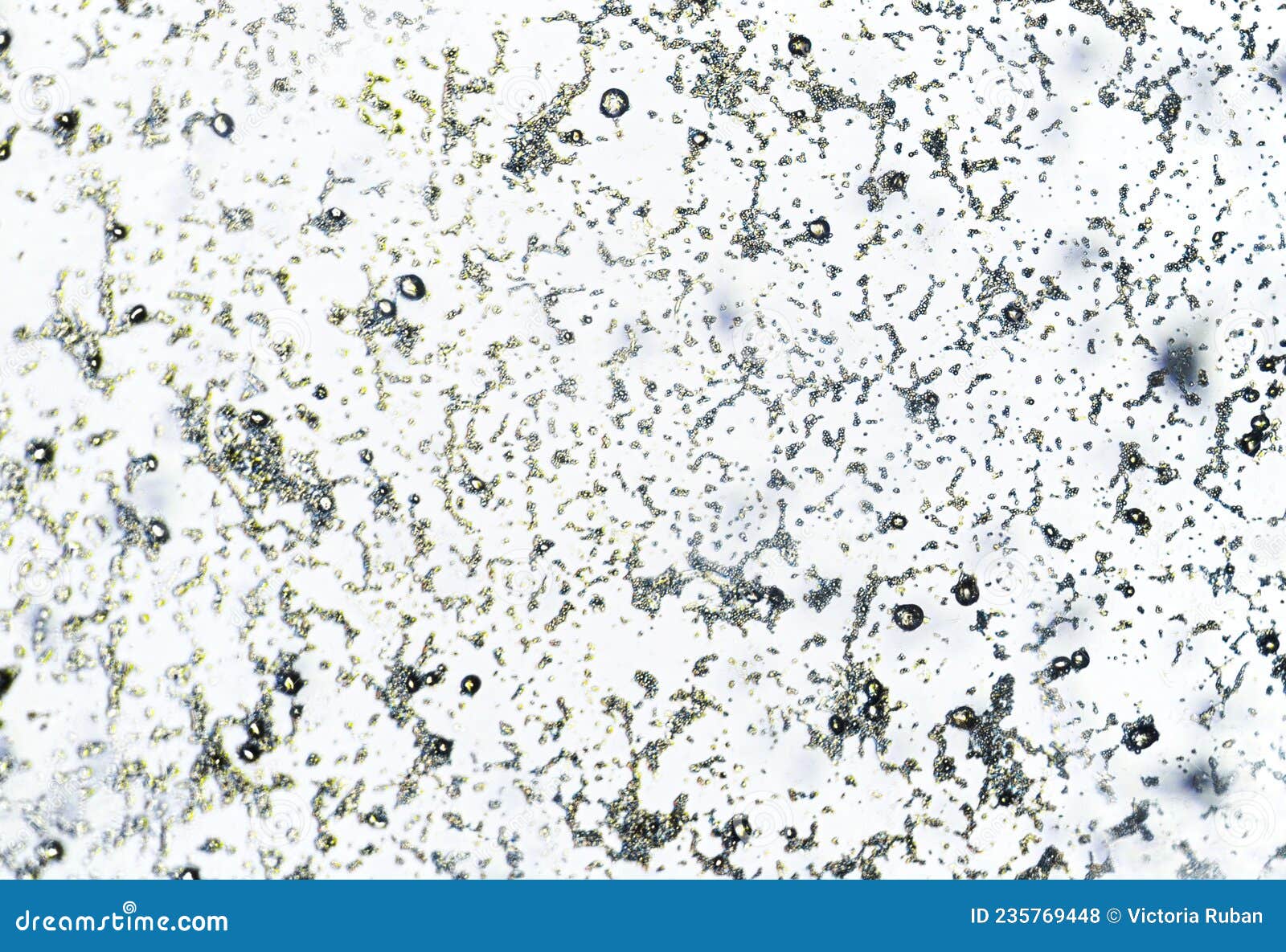 Mold Spores Under the Light Microscope, Orange Peel Mold Stock Photo ...