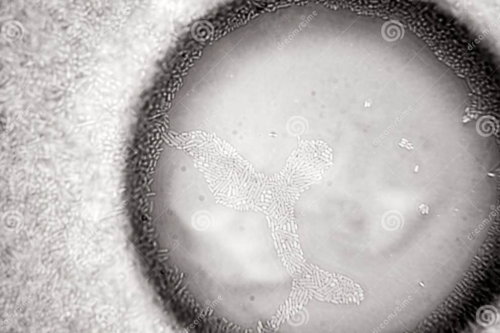 Molde en el microscopio imagen de archivo. Imagen de hermoso - 111147671