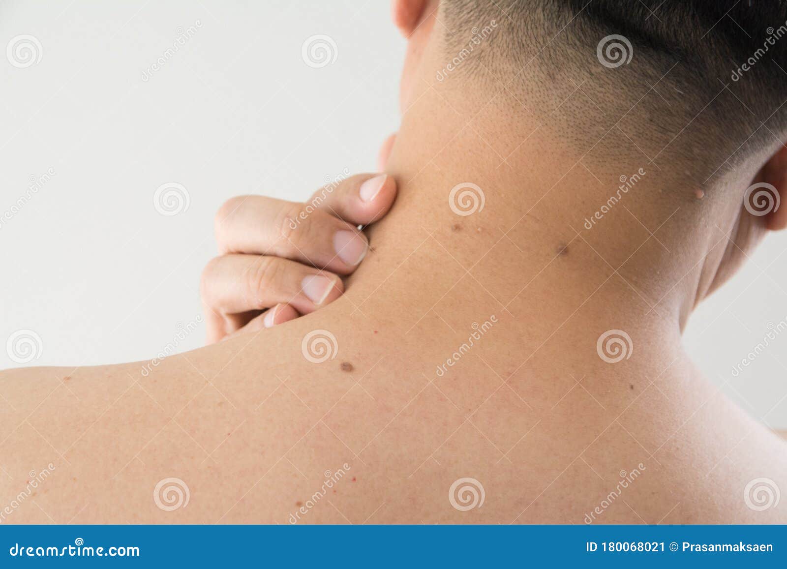 Mole on men`s skin stock image. Image of healthy, closeup - 180068021