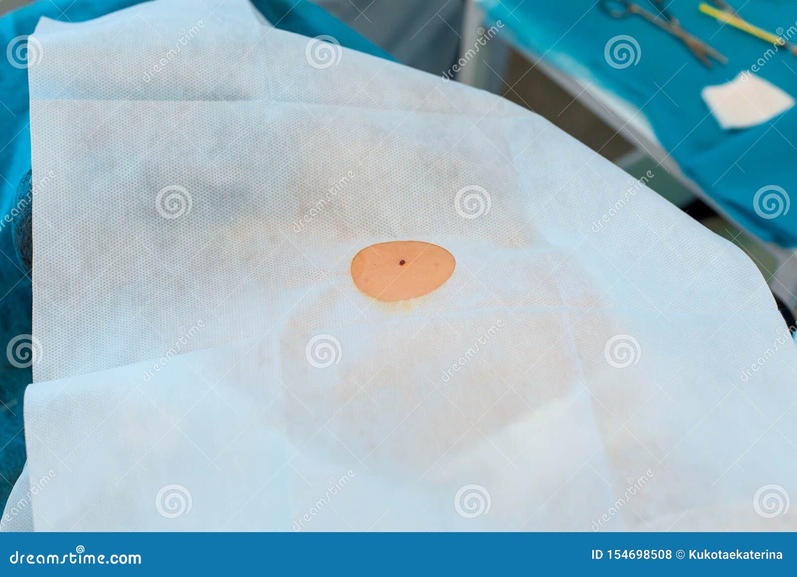 Sterilized Operating Room Ready For Thymectomy Procedure Stock Image ...