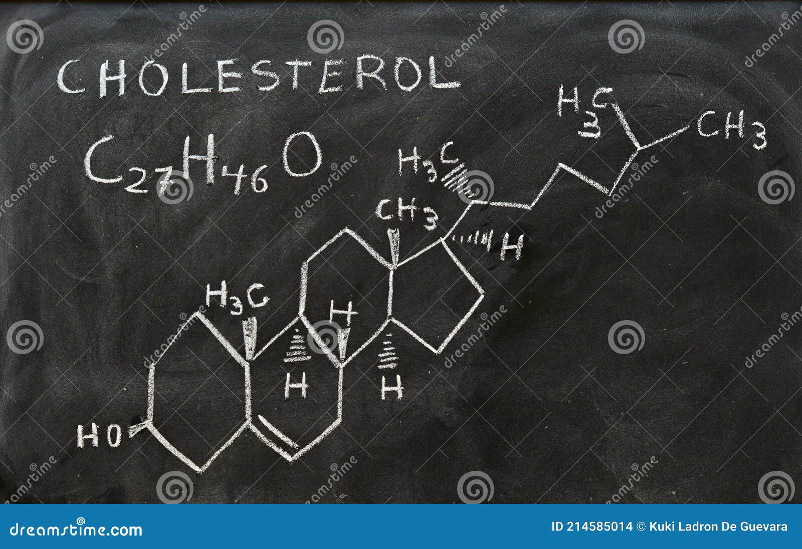Molecular and Structural Formula of Cholesterol Stock Photo - Image of ...