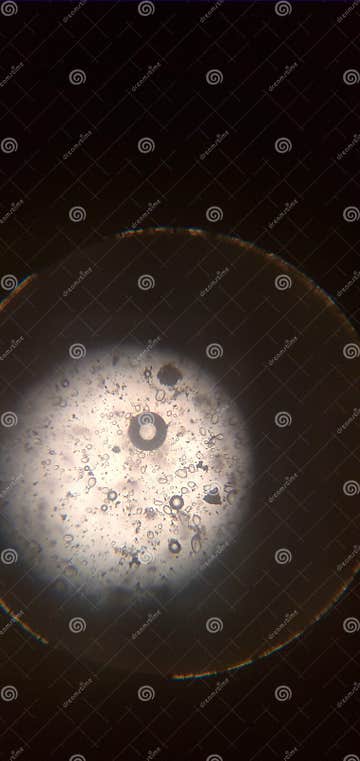 Molecules of Oxygen in the Lens of a Light Microsope Stock Image ...
