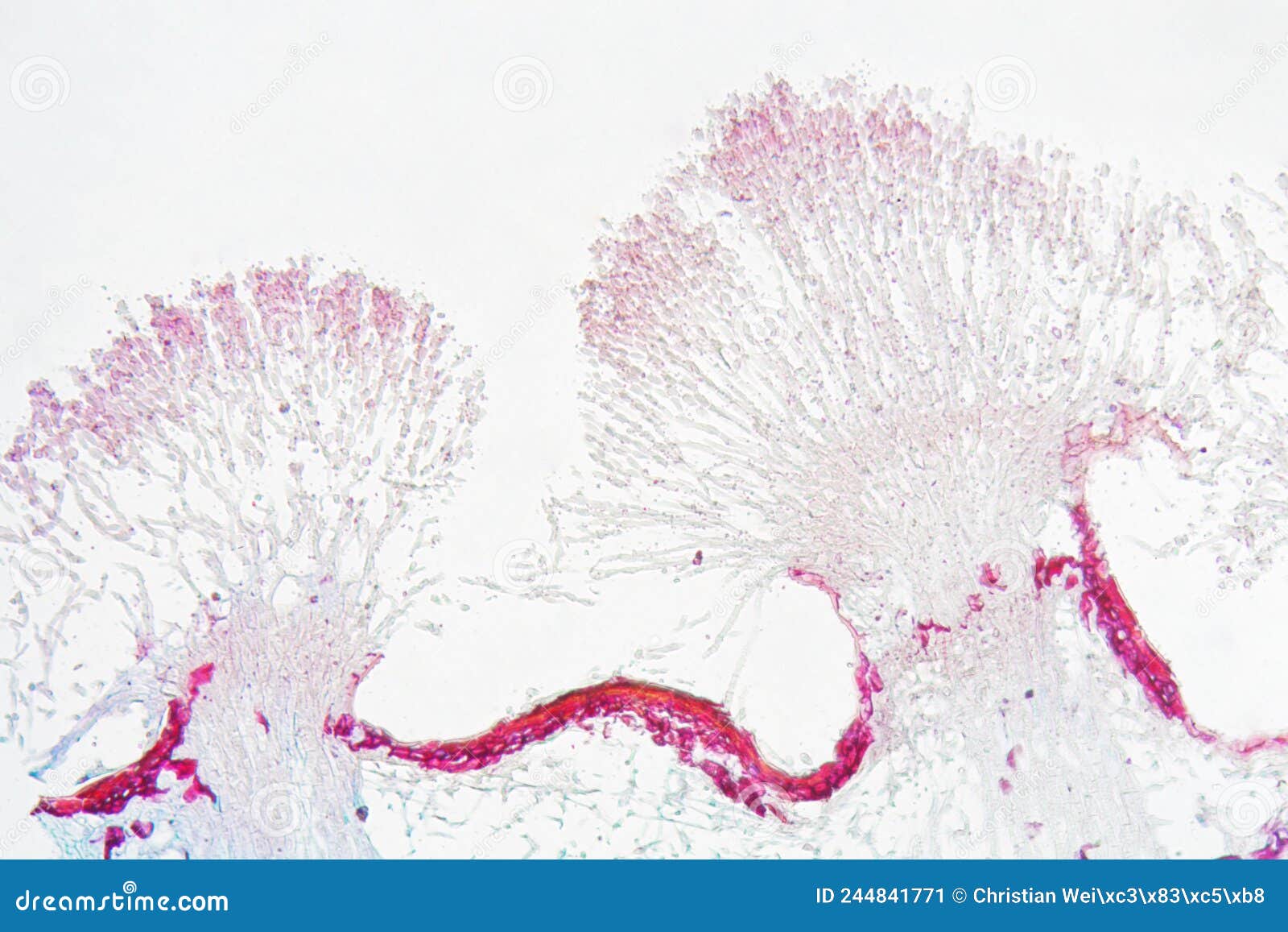 Monilinia Fructigena Under the Microscope Stock Image - Image of ...