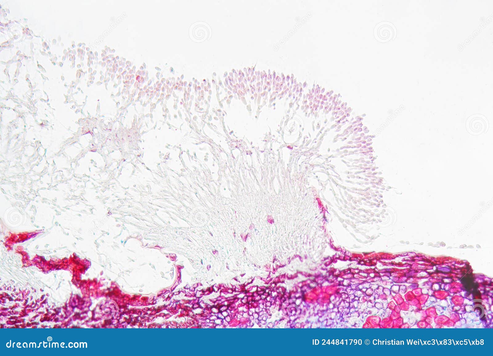 Monilinia Fructigena Under the Microscope Stock Photo - Image of ...