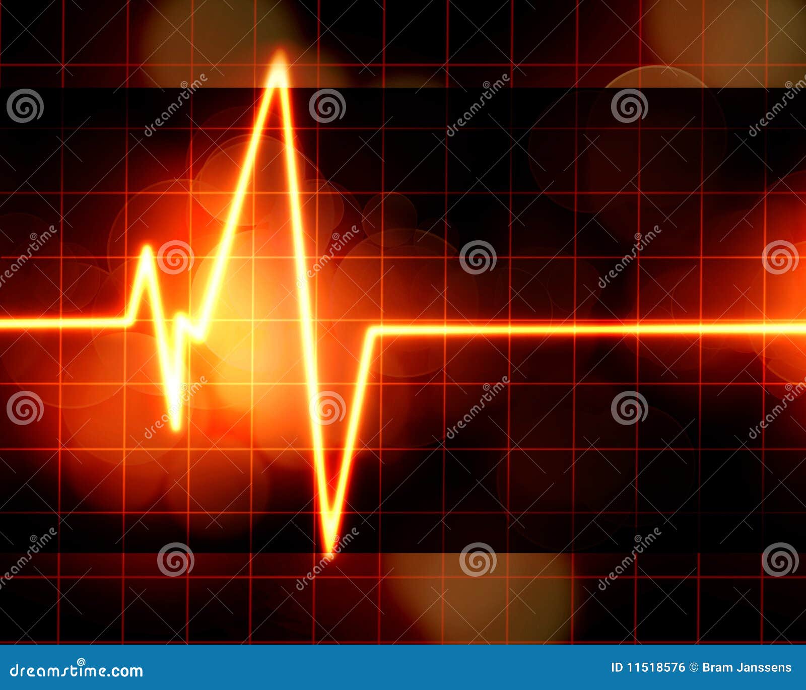 Moniteur de coeur illustration stock. Illustration du numérique - 11518576