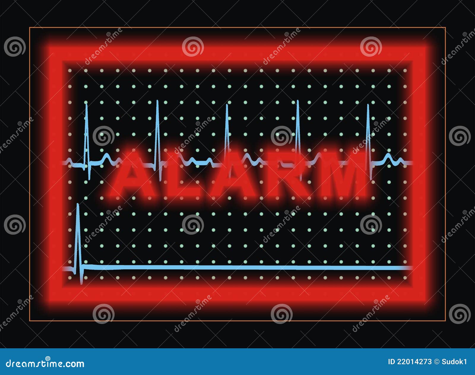 Monitor alarm stock illustration. Illustration of graph - 22014273