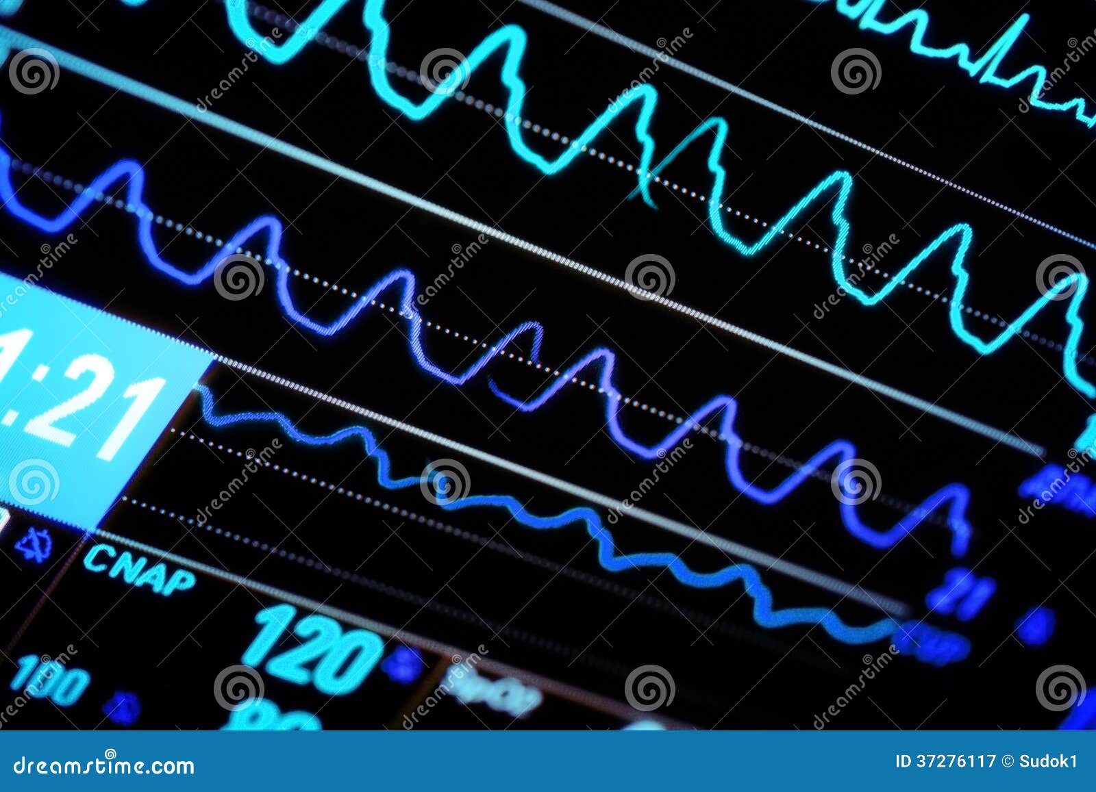 Monitor Contemporaneo Di ICU Immagine Stock - Immagine di ospedale ...
