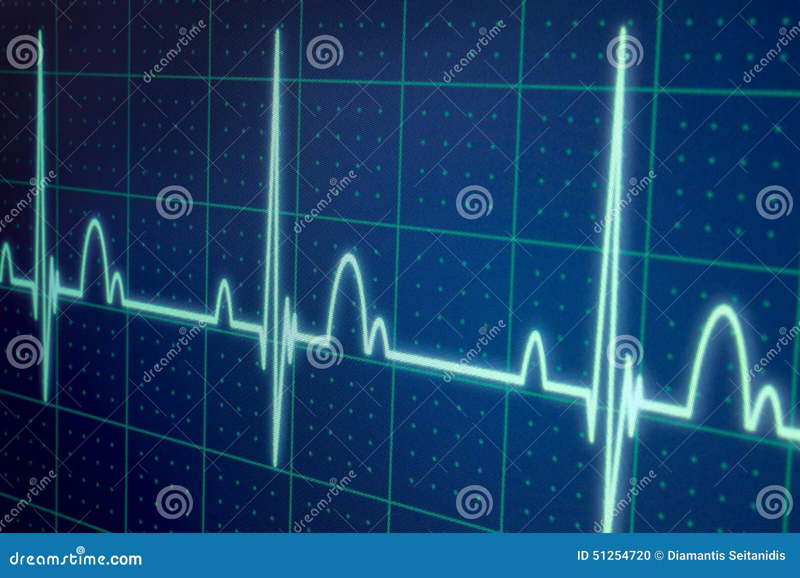 Monitor de ECG/del ECG foto de archivo. Imagen de alarma - 51254720