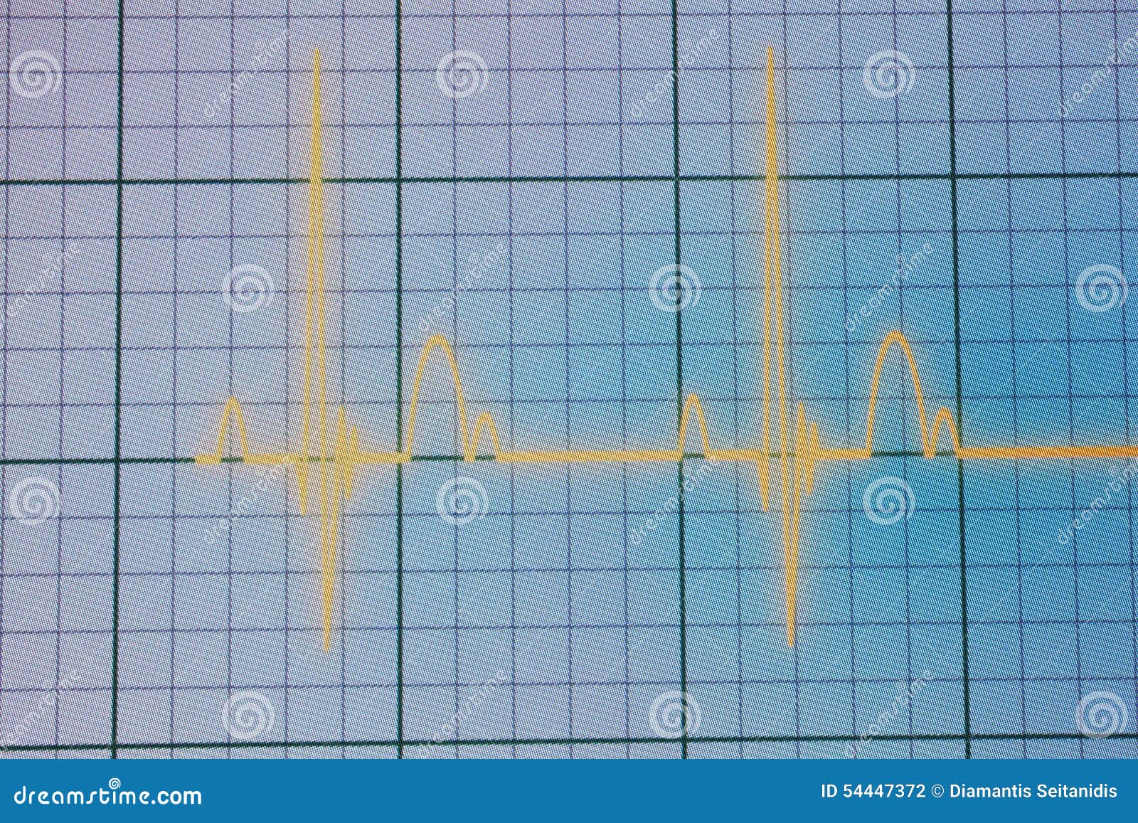 Monitor de ECG/del ECG foto de archivo. Imagen de cuidado - 54447372