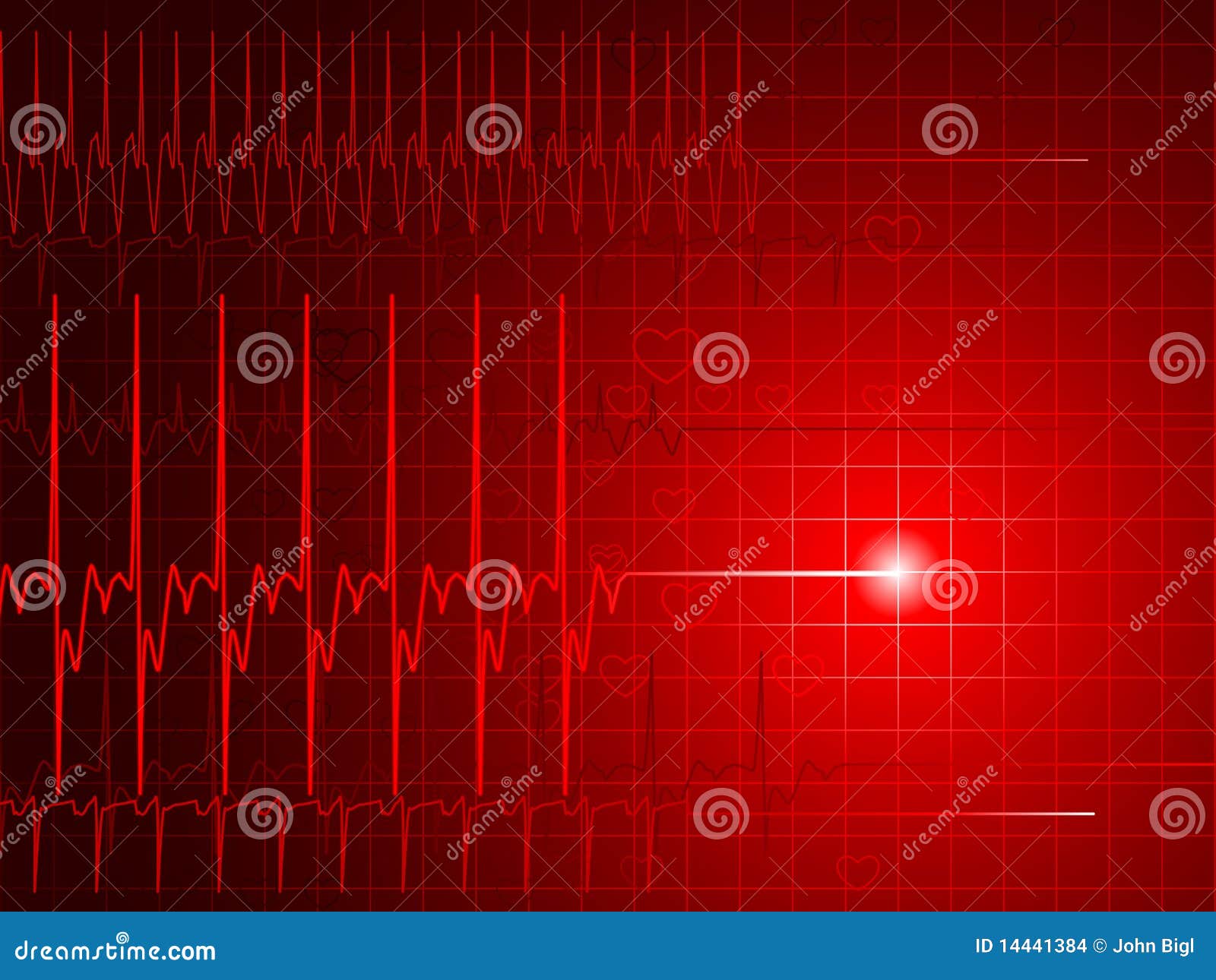 Monitor de Flatline ilustración del vector. Ilustración de cardiaco ...