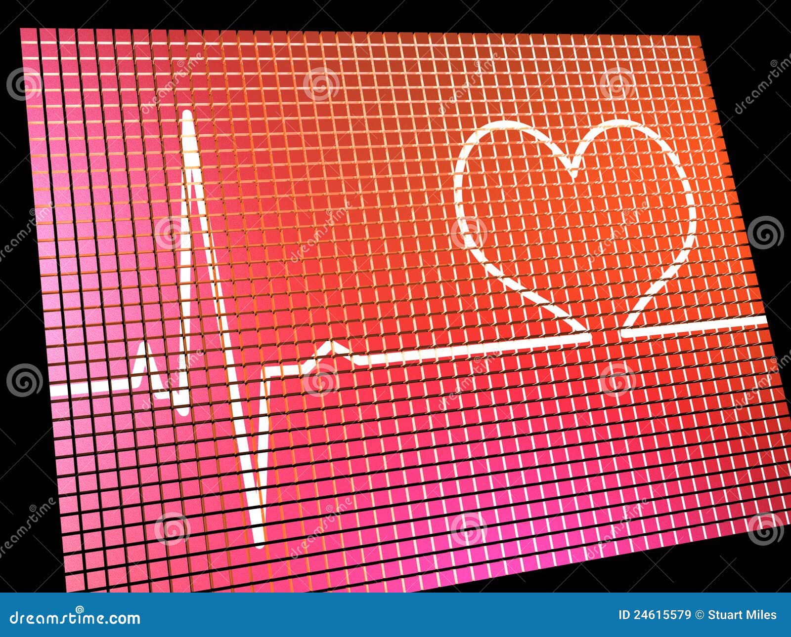 Monitor De Visualización Del Ritmo Cardíaco Stock de ilustración ...