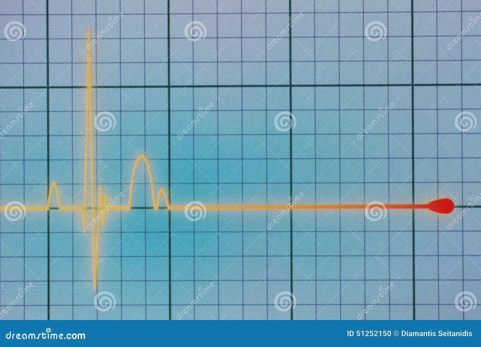 Monitor Elettrocardiogramma/di ECG Fotografia Stock - Immagine di ...