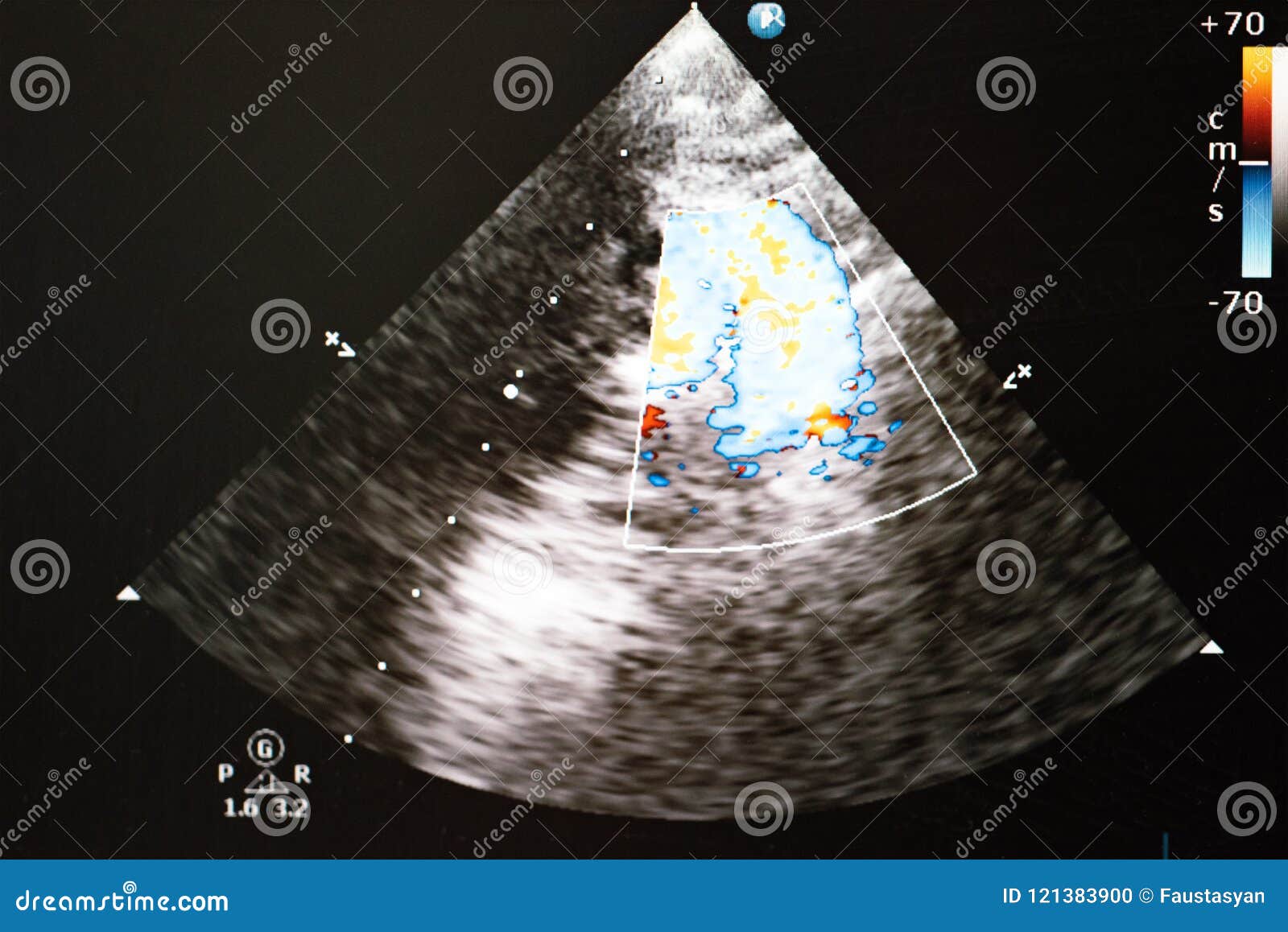 Doppler Mapping Photos - Free & Royalty-Free Stock Photos from Dreamstime