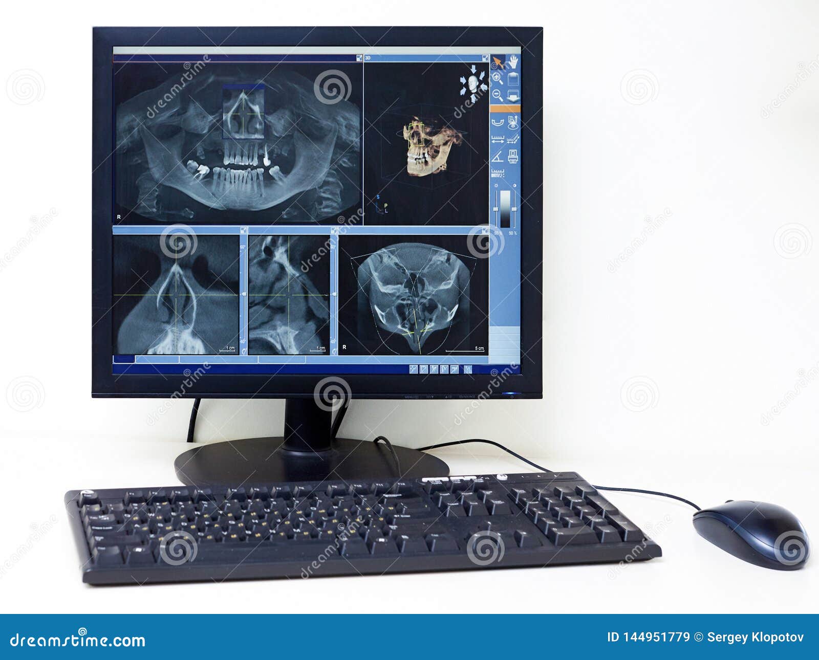Monitor a X-ray Computer Setup in a Dental Clinic Lab Stock Image ...