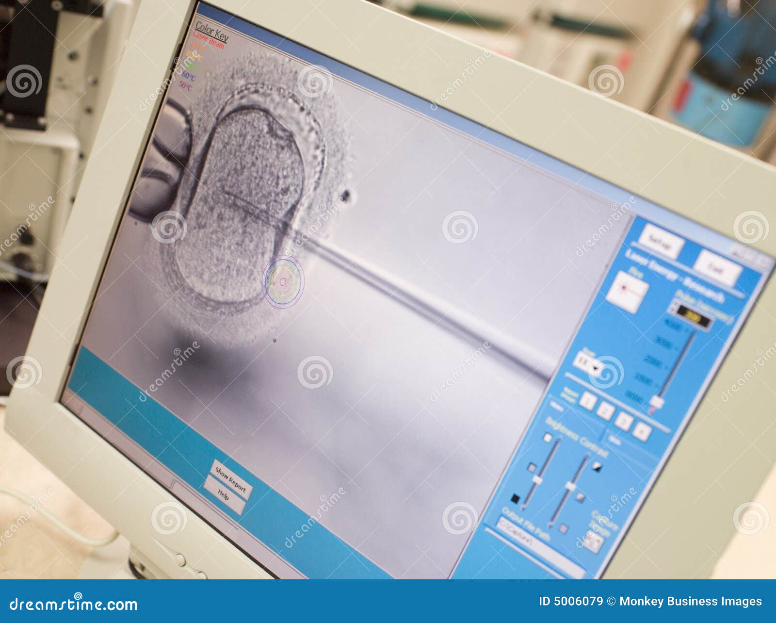 EKG Monitor In Intra Aortic Balloon Pump Machine. Royalty-Free Stock ...
