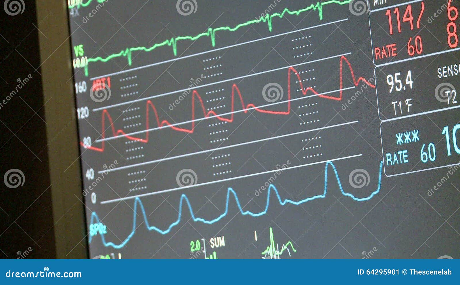 Vital Signs Stock Footage & Videos - 78 Stock Videos