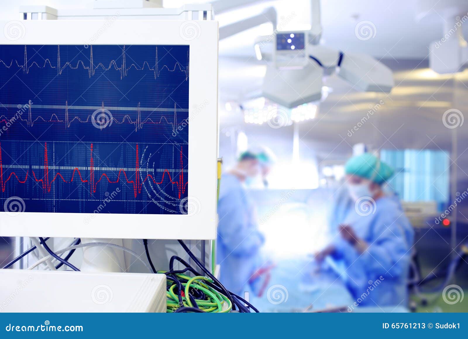 Monitoring of Cardiac Function during Surgery Stock Image - Image of ...