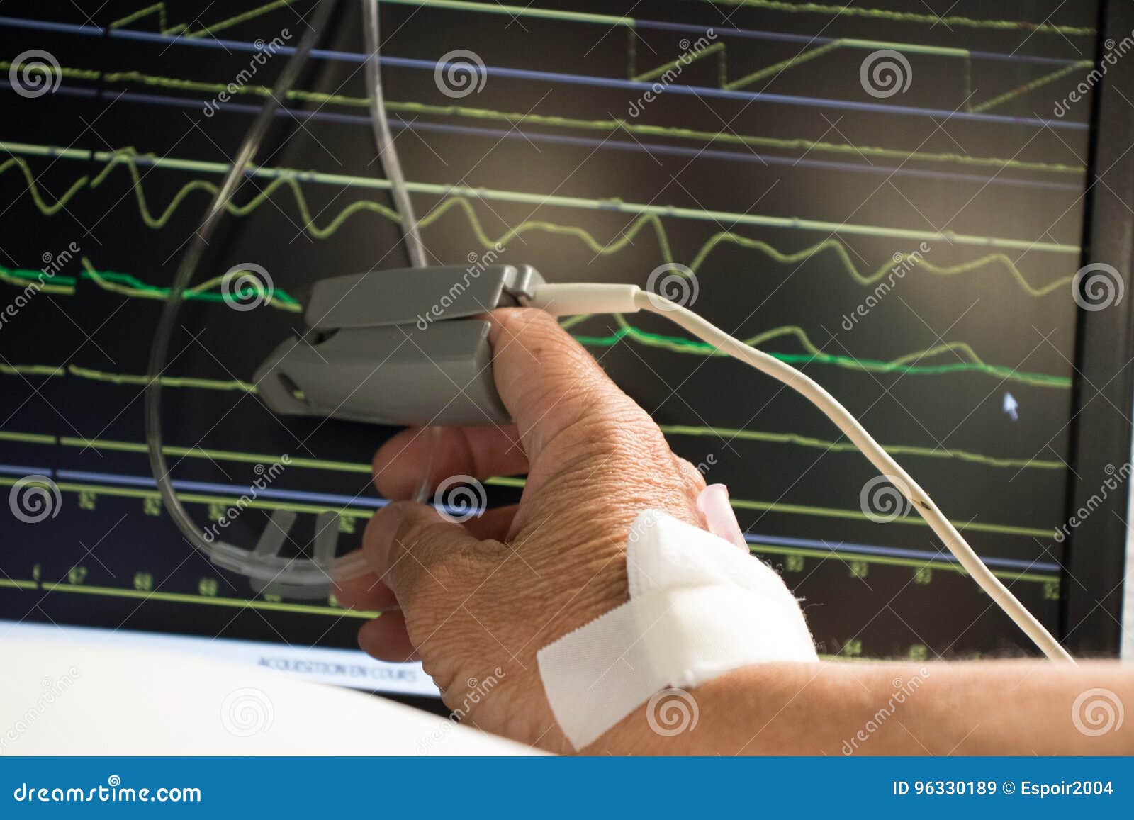 Monitoring of Patient in Hospital. Stock Image - Image of body ...