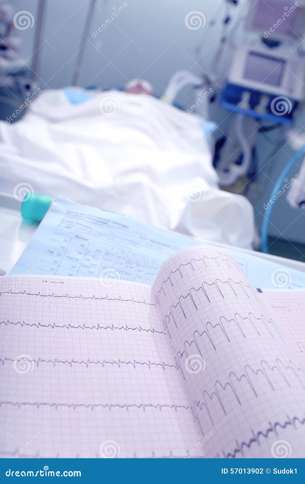 Monitoring of the Patient S ECG Stock Photo - Image of concept, device ...