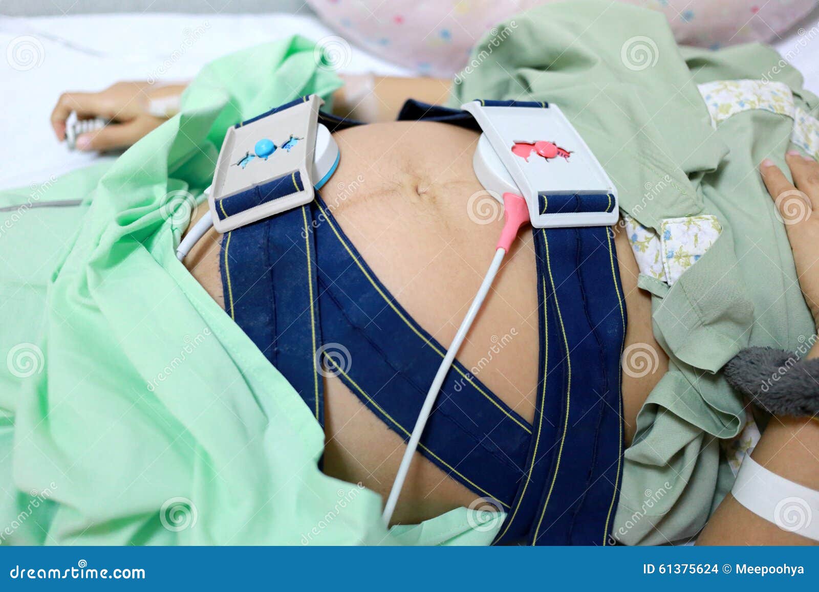 Monitoring Tool of Cardiac Function Baby. Stock Photo - Image of ...