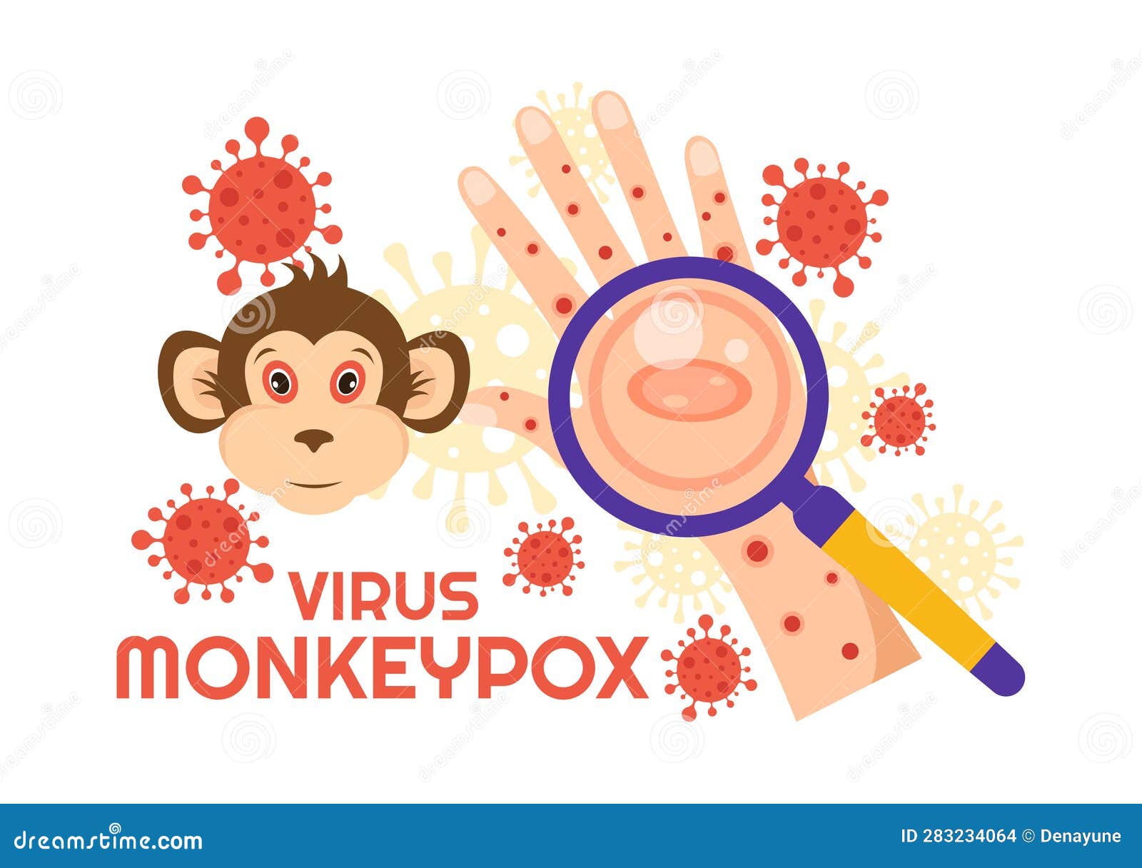 Monkey Pox Outbreak Vector Illustration of Virus Symptoms in Humans ...