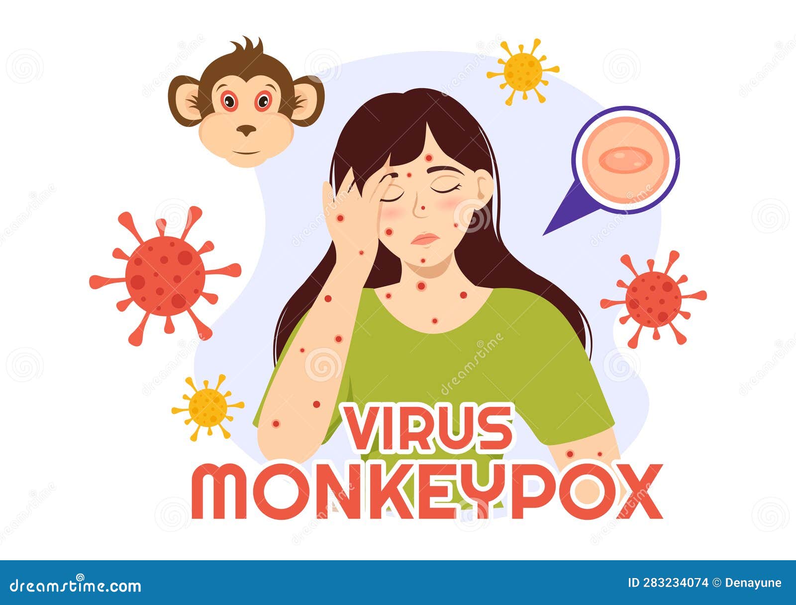 Symptoms Of Monkeypox. Sketch. Headache, Fever, Muscle Pain, Swollen ...