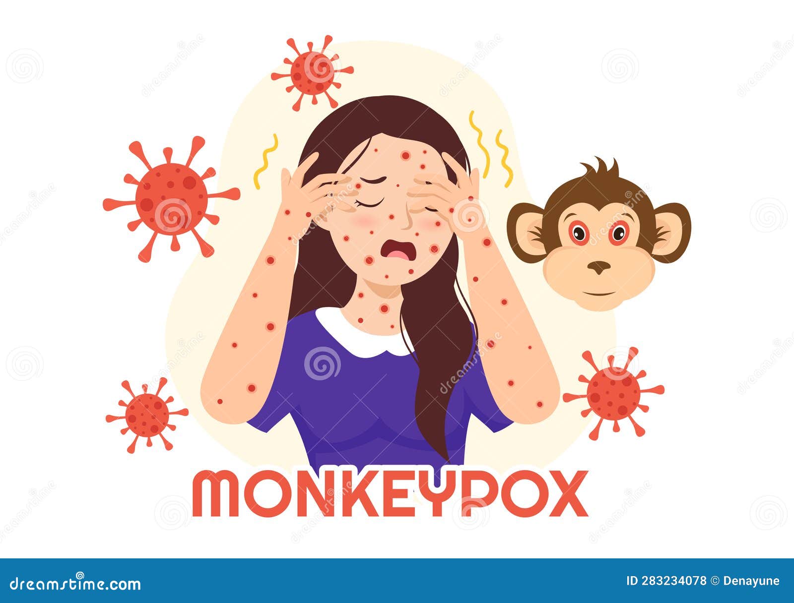 Monkey Pox Outbreak Vector Illustration of Virus Symptoms in Humans ...