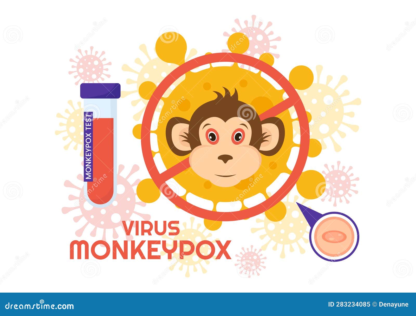 Monkey Pox Outbreak Vector Illustration of Virus Symptoms in Humans ...