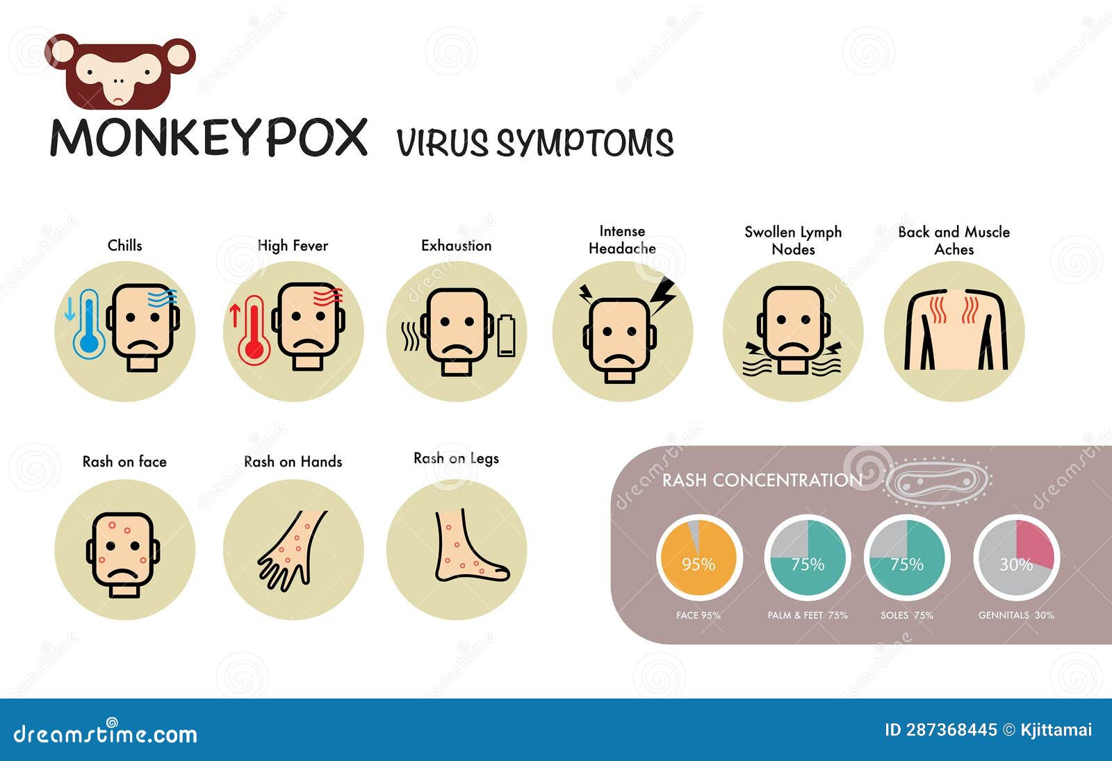 Monkeypox Virus Symptoms Pandemic Infographic Chart Stock Illustration ...