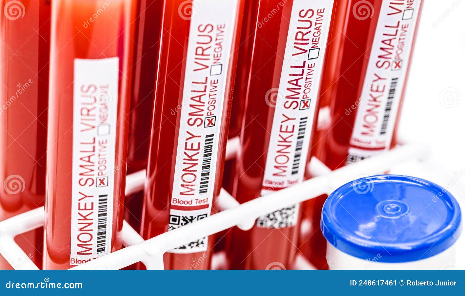 Smallpox Blood Sample Royalty-Free Stock Photography | CartoonDealer ...