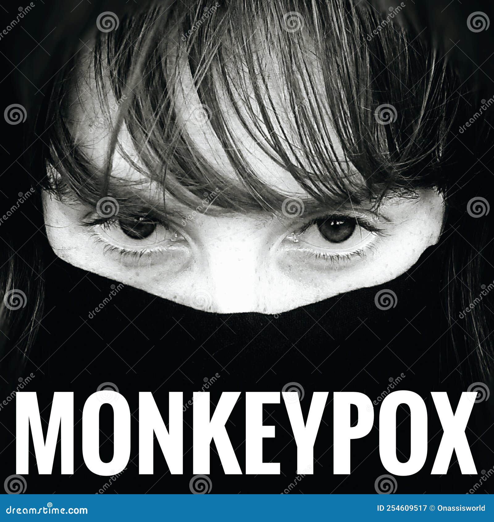 Monkeypox Outbreak, MPXV Virus, Infectious Disease Spreading, Sick ...