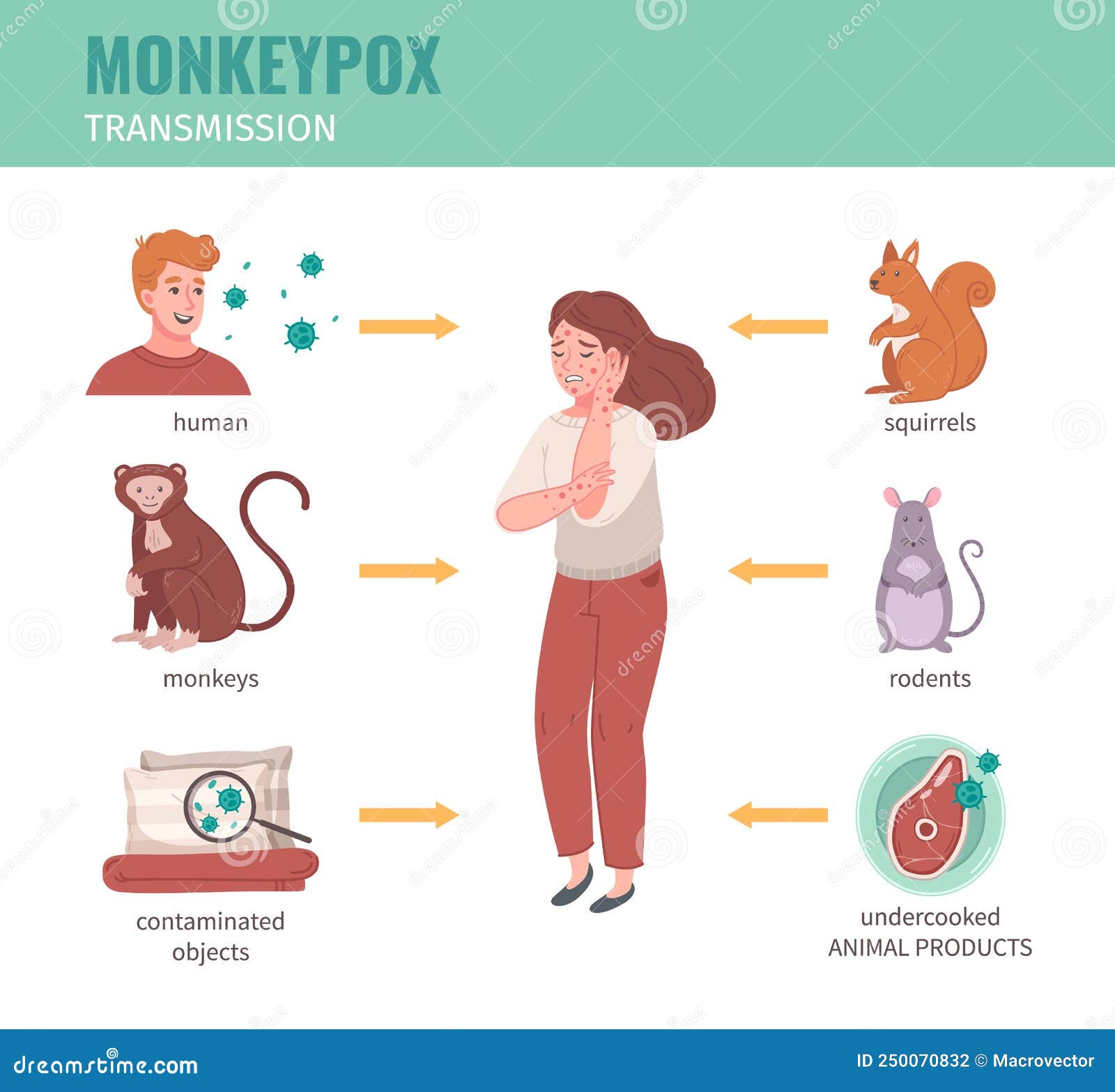Monkeypox Transmission Infographics Stock Vector - Illustration of ...